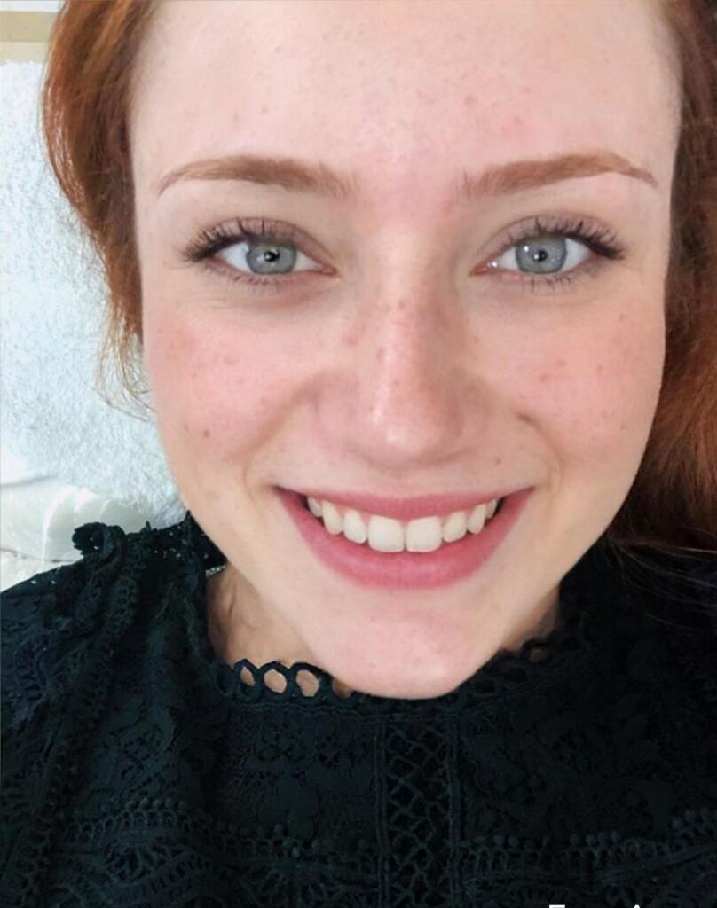 Beautiful Redheads and Freckle girls on Twitter: "Like and retweet if you love her! #freckles # ...