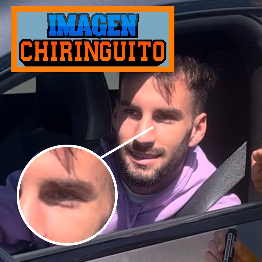 El Chiringuito TV on Twitter: "🚨 IMAGEN EXCLUSIVA EL CHIRINGUITO 🚨 📸 Así está el pómulo y ojo de ...
