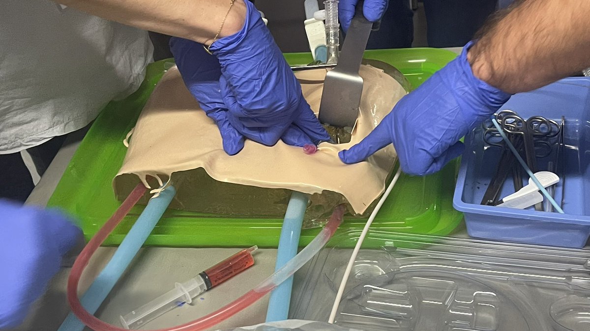 M Velia Antonini on Twitter: "Time for percutaneous & hybrid (cut-down technique) cannulation ...
