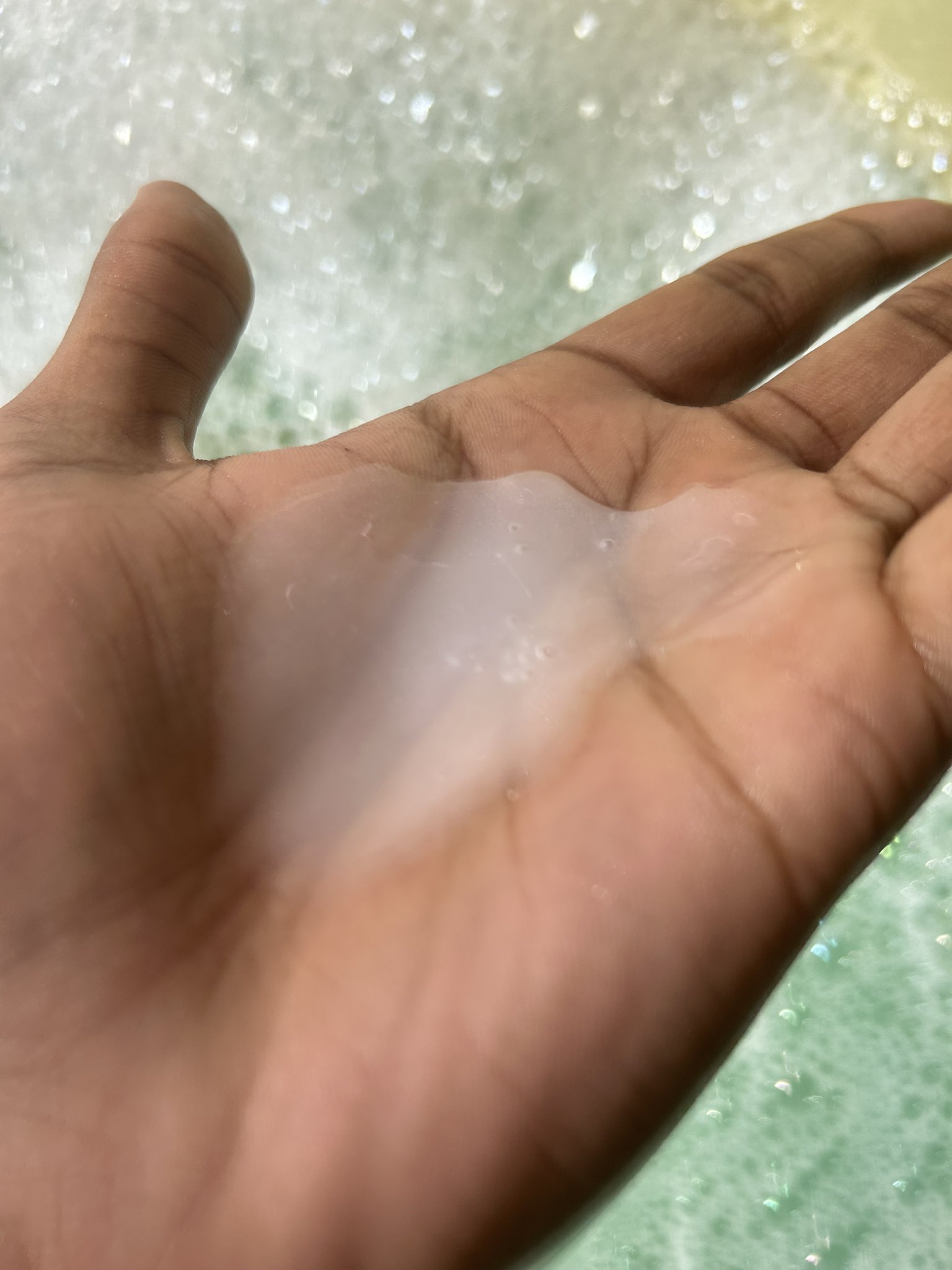 Yellow Semen Color Yellow Semen: Can Abstinence Be A Cause | PPT