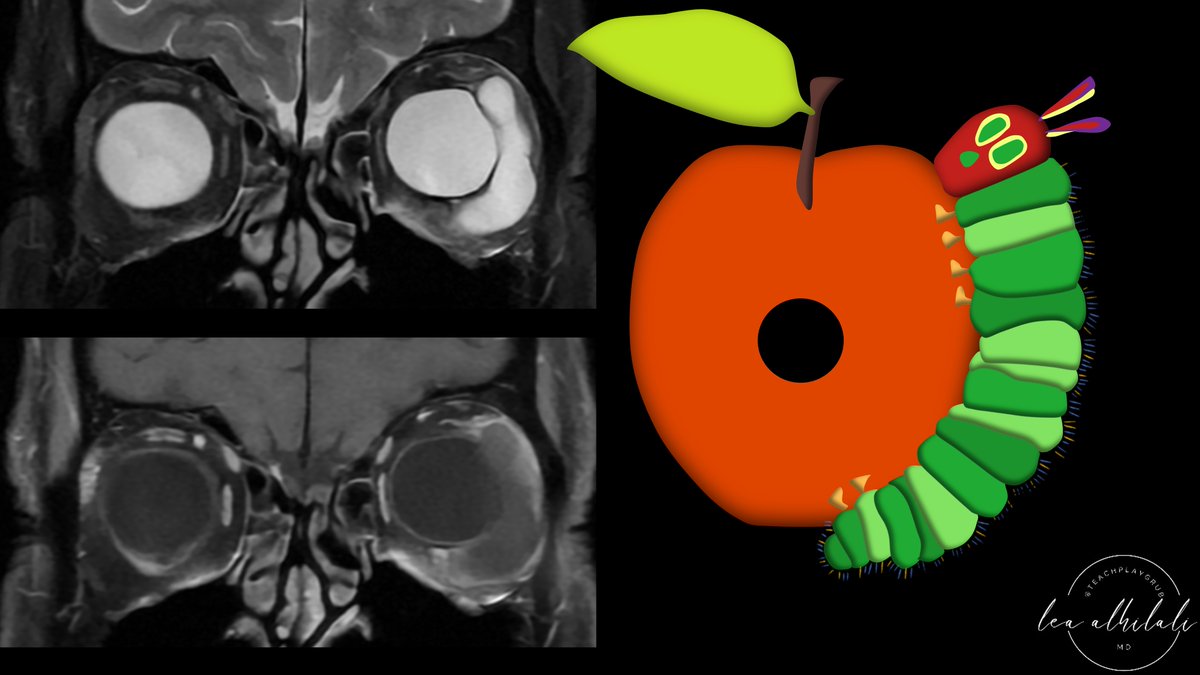 1/Just because the finding is obvious doesn’t mean the case is easy ...