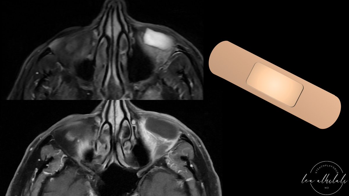 1/Just because the finding is obvious doesn’t mean the case is easy ...