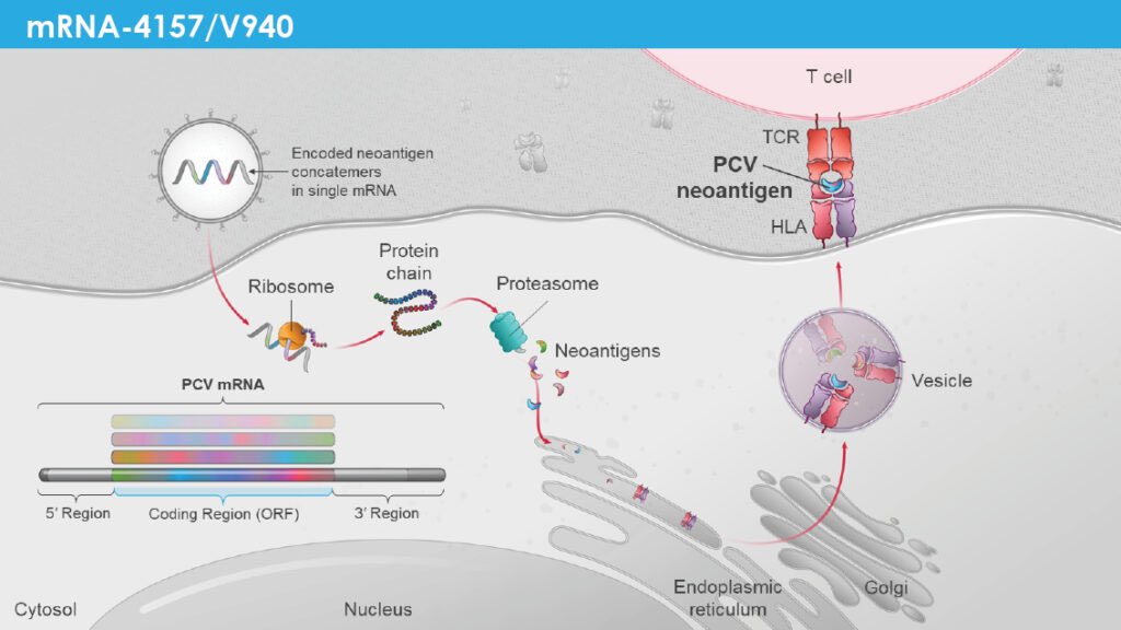 Moderna anuncia su vacuna contra el cáncer (melanoma). La compañía ...