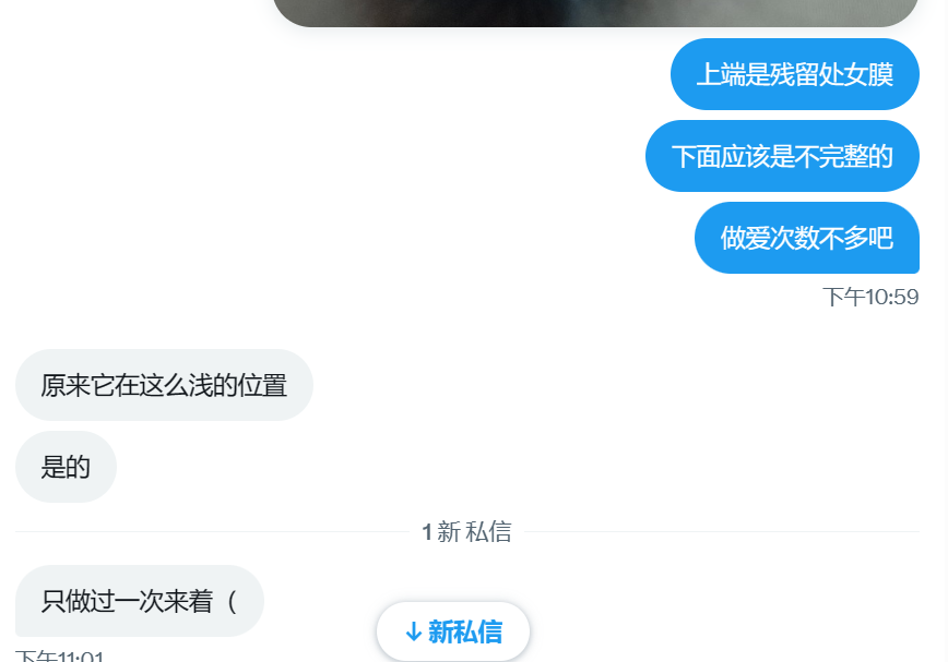 性学larry老师 On Twitter 阴蒂包皮覆盖住了阴蒂头,但包皮弓不算狭窄。如果上拉应该可以外露部分阴蒂头,不影响体感和敏感度,可以正常阴蒂高潮。小阴唇边缘略黑,属于正常色素沉淀
