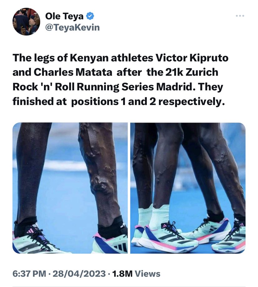Kenyan Runner Legs
