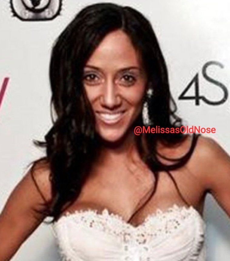 Melissa's Old Nose on Twitter: "One nose job and contouring 👀 #RHONJ"