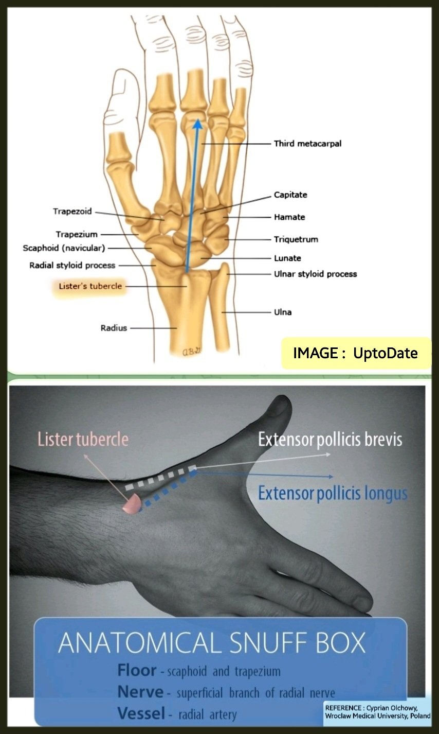 Listers Tubercle Of Radius