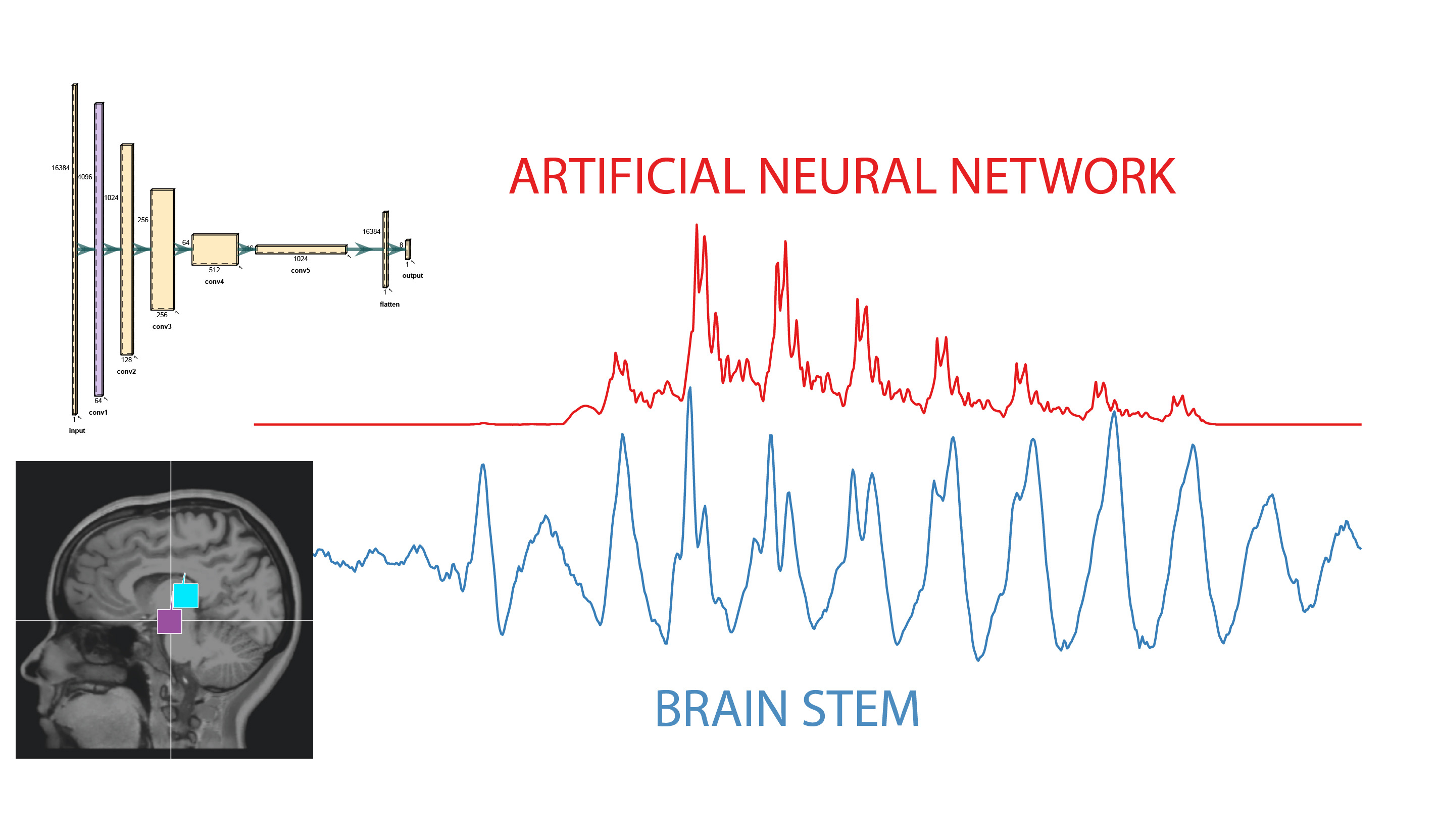Artificial Neural Network Brain