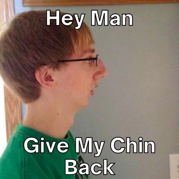 Mouth breathing has a major influence on the shape of your skull and ...