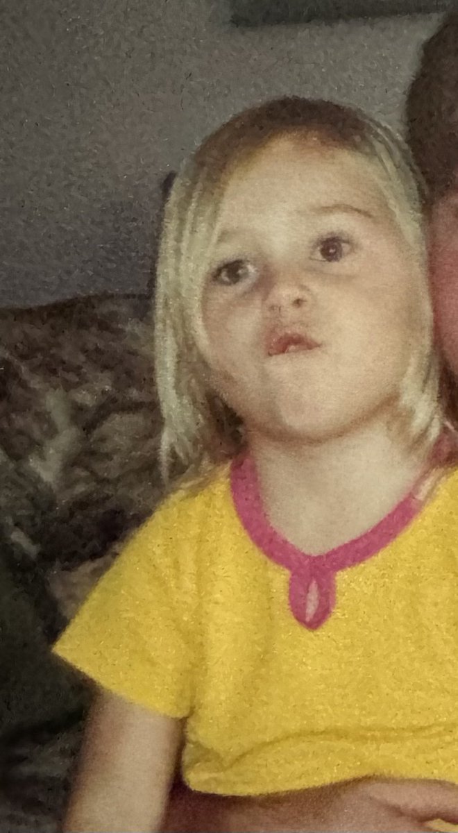 teaz 🫣 on Twitter: "skill issue"