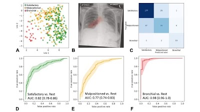 Radiology: Artificial Intelligence on Twitter: "#DeepLearning model for nasogastric tube ...