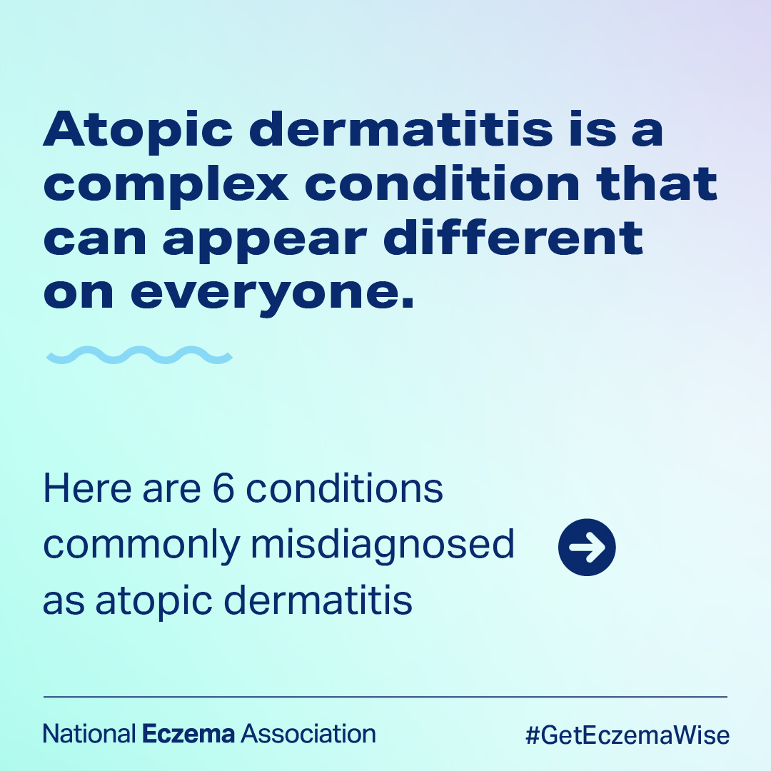 National Eczema on Twitter: "🍎🍊 Is it really atopic dermatitis? 🍊🍎 ...