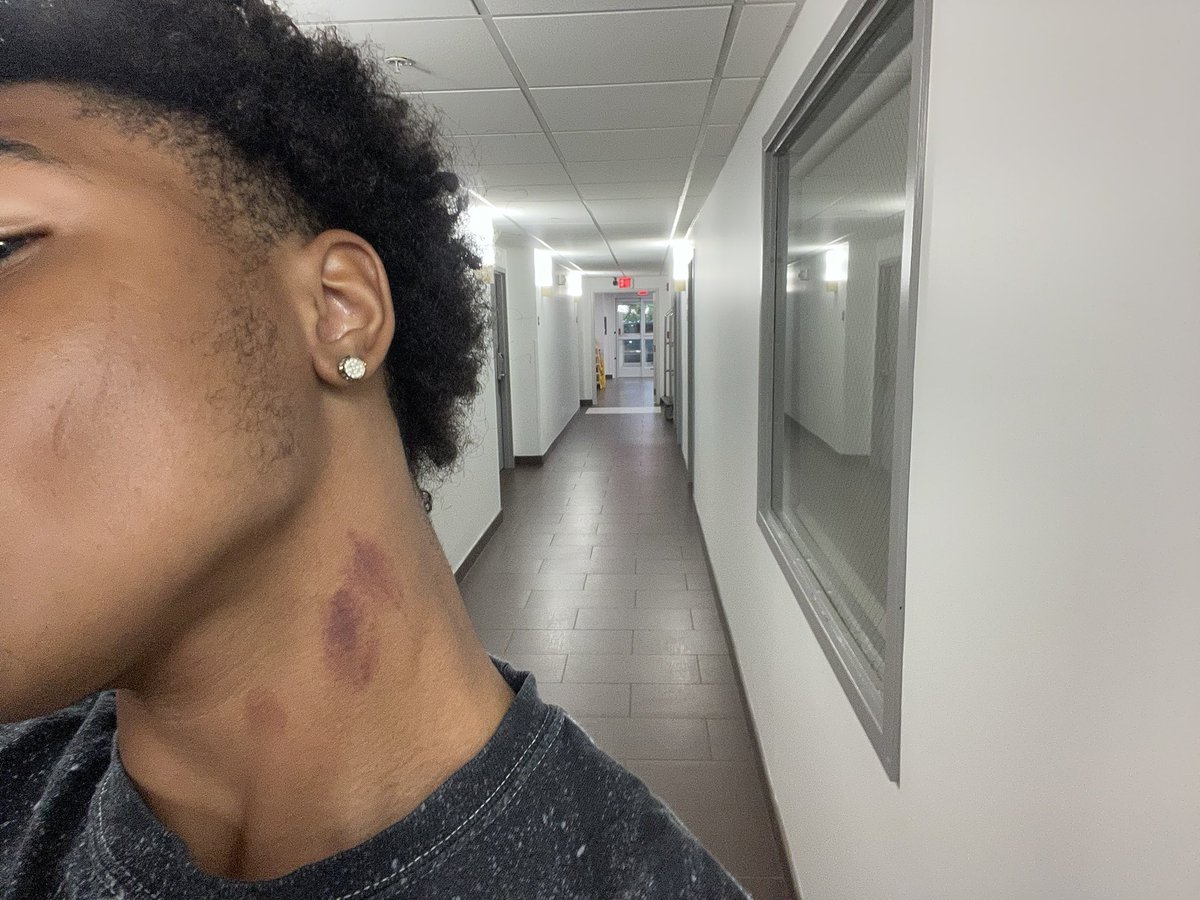Do Guys Get Hickeys