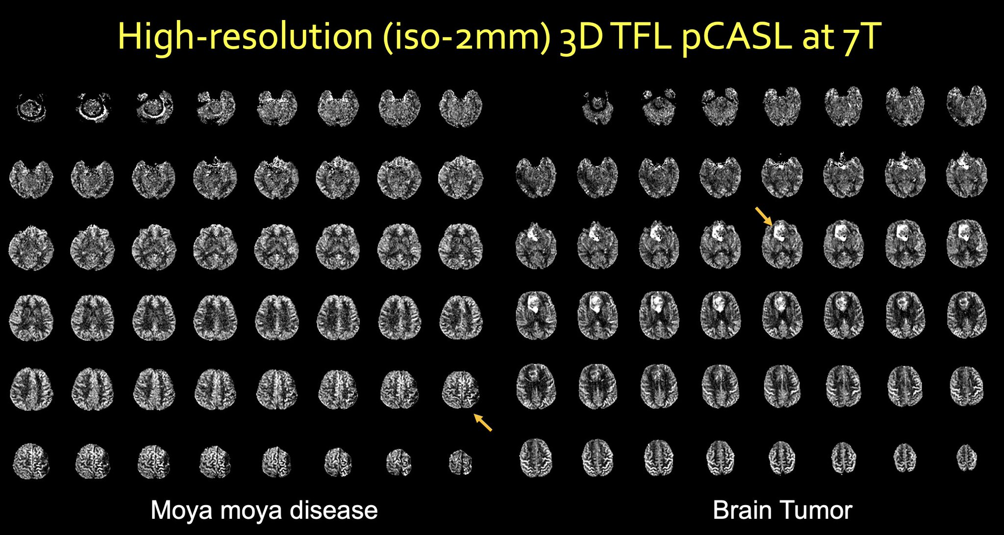 Danny JJ Wang on Twitter: "After 5+ years hard work on 7T, our LOFT lab can comfortably perform ...