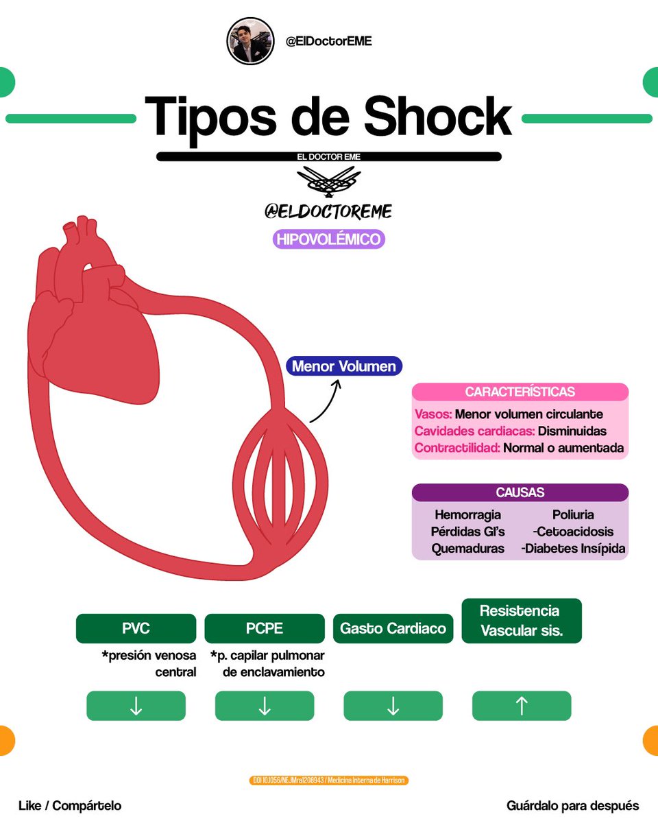 Choque Distributivo Cardiogenico at Caitlyn Tooth blog