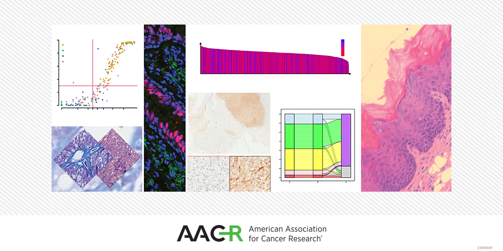Cancer Discovery on Twitter: ""The Best of the AACR Journals” is a collection of our most cited ...