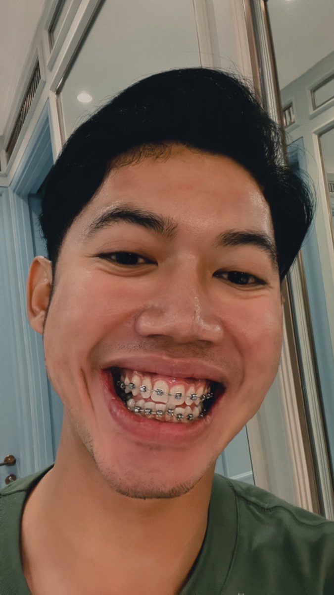 L’ombre Dans Leau on Twitter: "Gigi udah berantakan kek hidup. Sorry guys ga bisa nyep*ng dulu ...