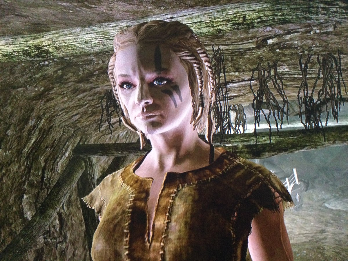 「自分の口でも実感したこと。 鉄フライパンってすごいね! #日常漫画 」時任奏の漫画