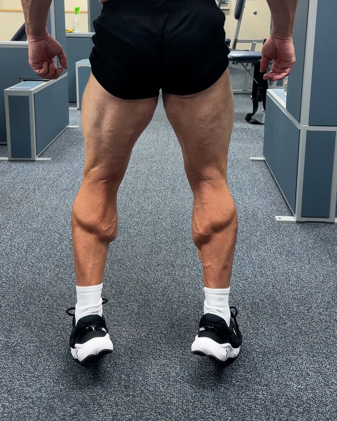 Huge Calf Muscles