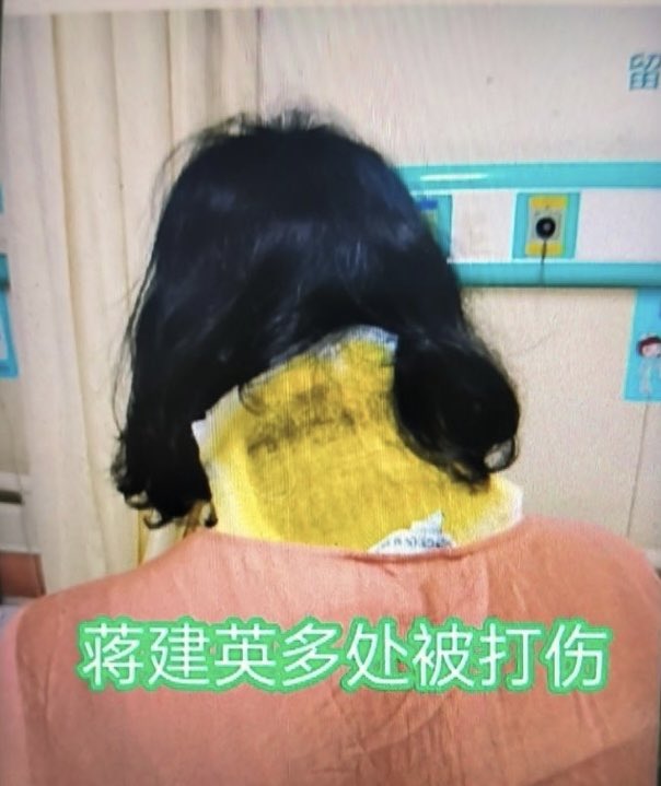 今日質疑網 On Twitter 法律受到践踏,去京维权却遭受刑拘,这样的情况何以为理? 2021年6月11日,江苏无锡蒋建英的合法房屋遭到非法强拆,导致他的眼睛被喷辣椒水,身体遭受严重伤害。