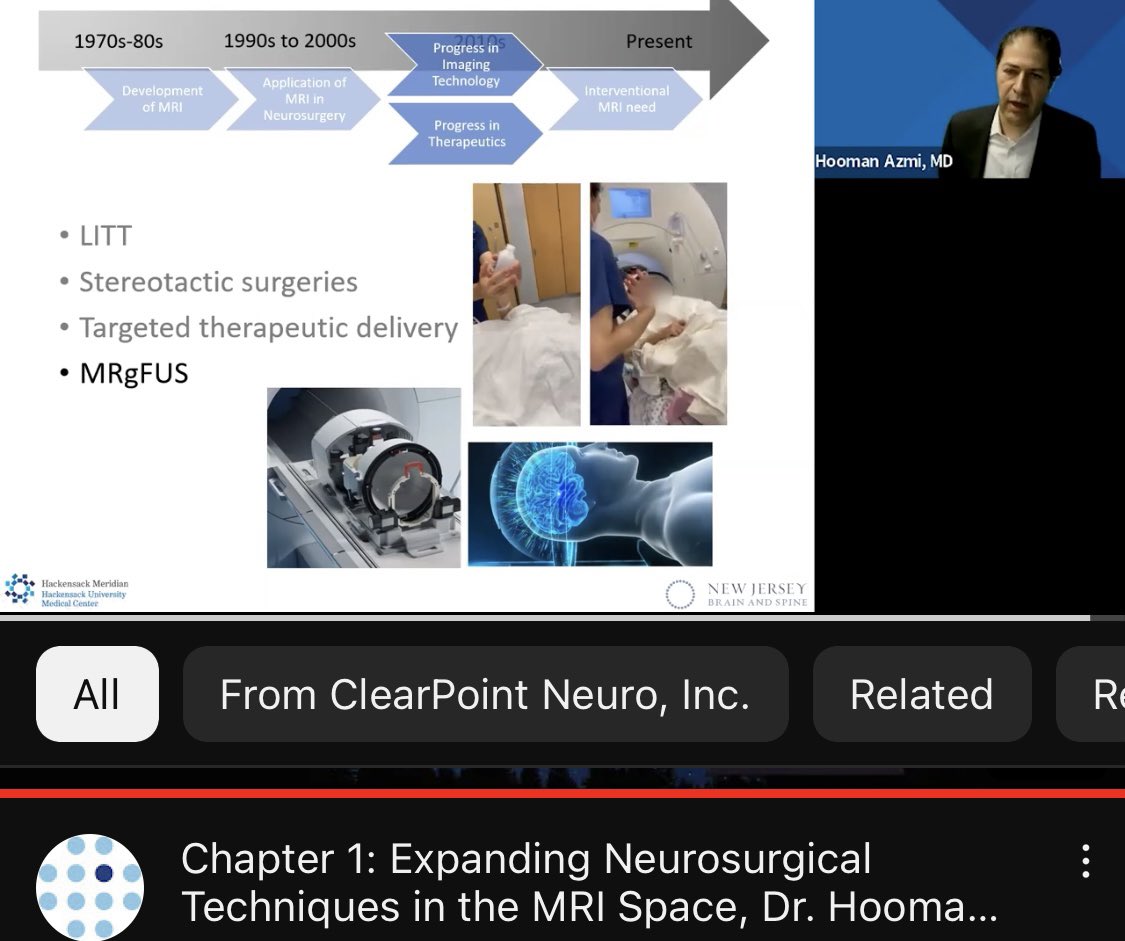 Peter Mantas on Twitter: "$CLPT MRI guided focused ultrasound as a neuro technique"