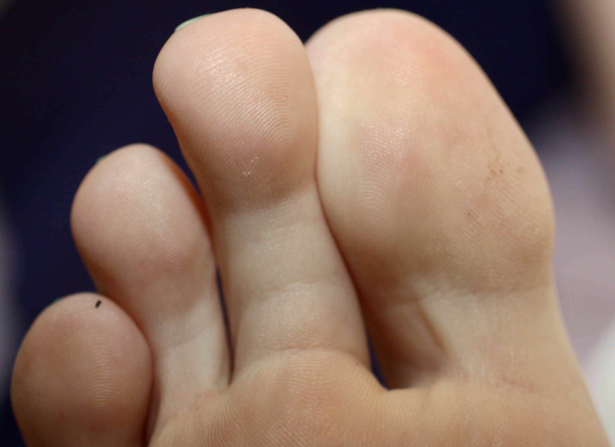Moms Huge Feet On Twitter How Close Can You Get Longtoes