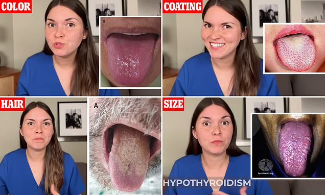 Daily Mail Us On Twitter Everyone Say Ahhh Doctor Reveals What