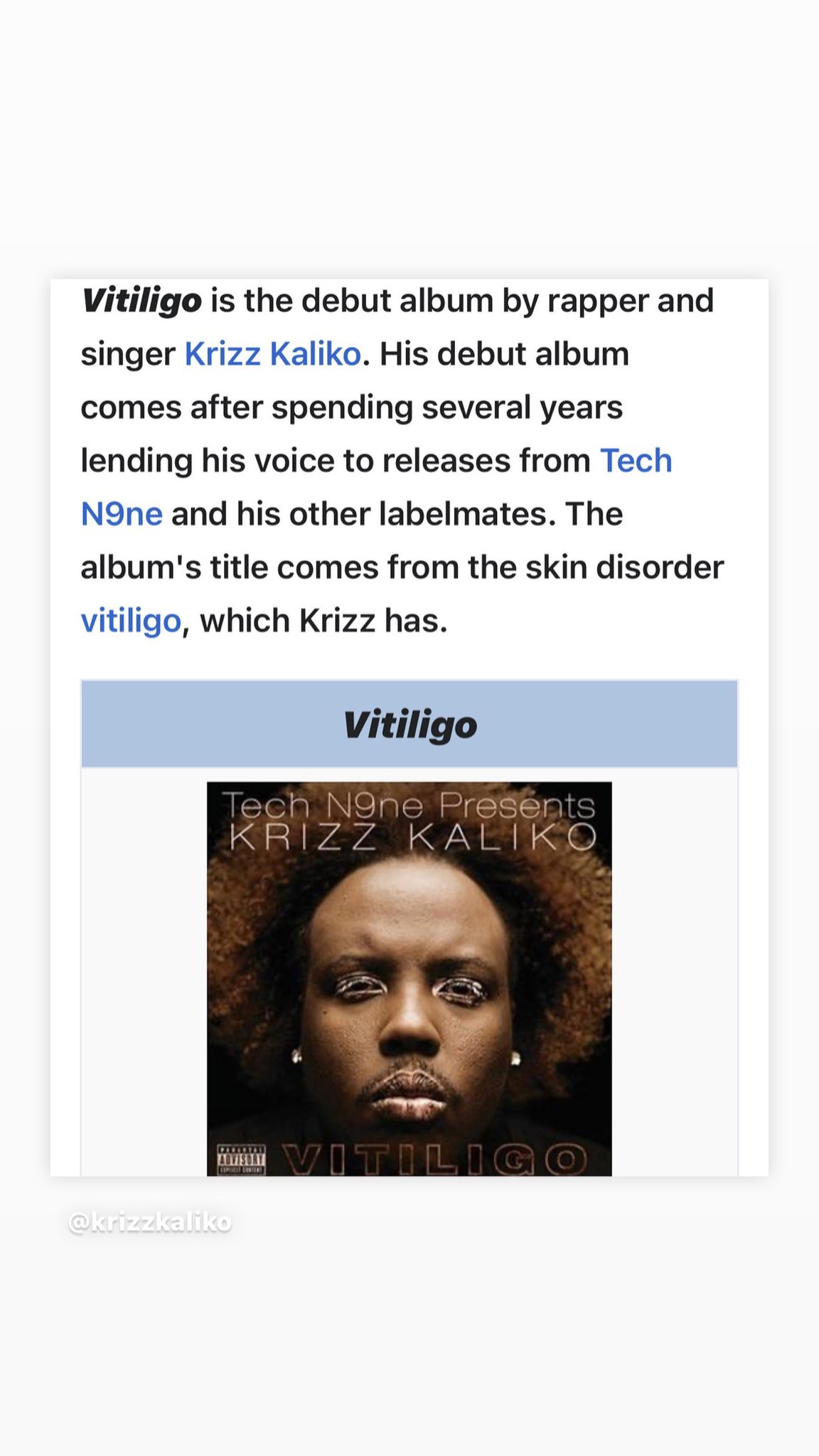 Krizz Kaliko Vitiligo 17 Famous People With Vitiligo Living Dappled
