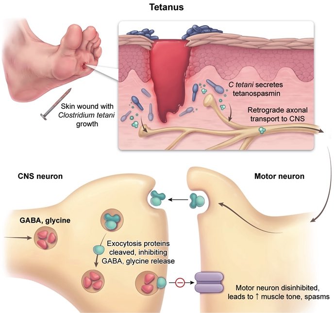 Clostridium Tetani Diagram