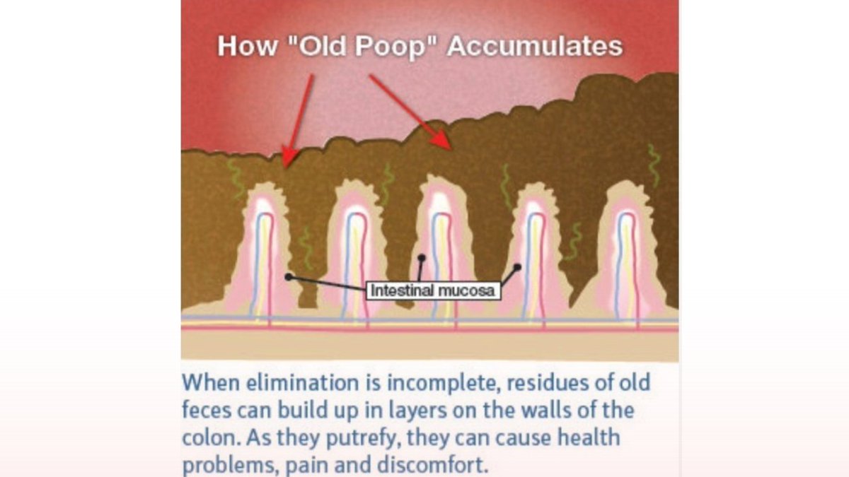 The Secret to Relieving Constipation: (It's Not What You Think...) 🧵⤵️ ...