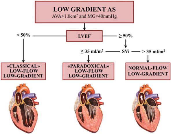 How severe is the “Severe Aortic Valve Stenosis” ? 🤨 🧵 #MedTwitter # ...