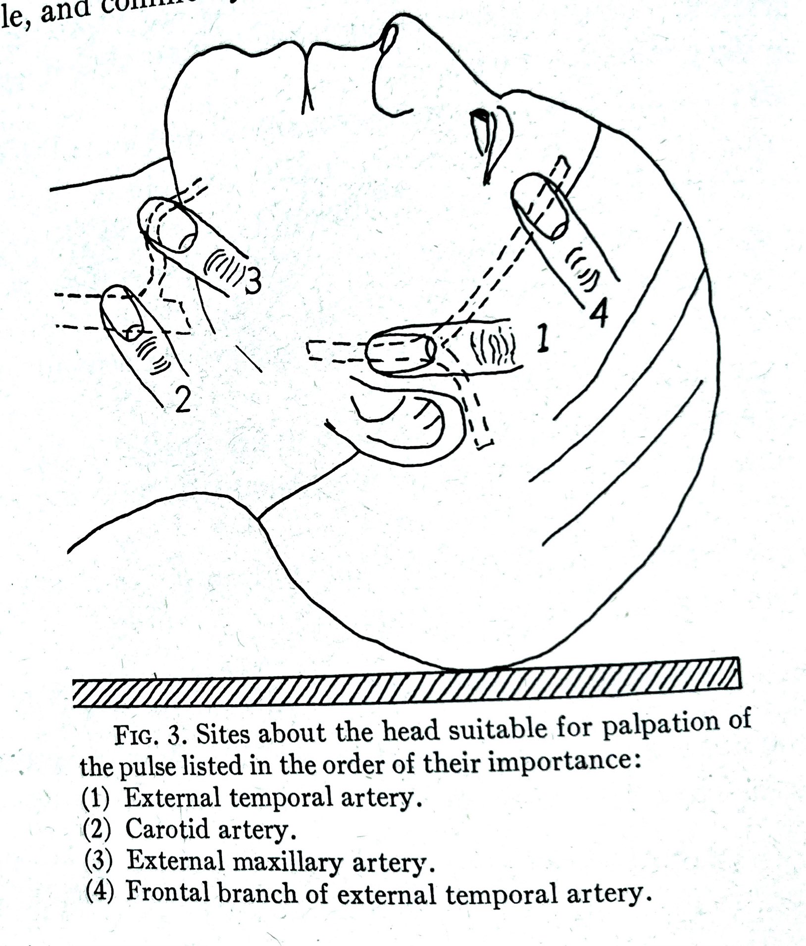 Palpate Temporal Artery