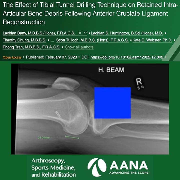 Interarticular Ligament