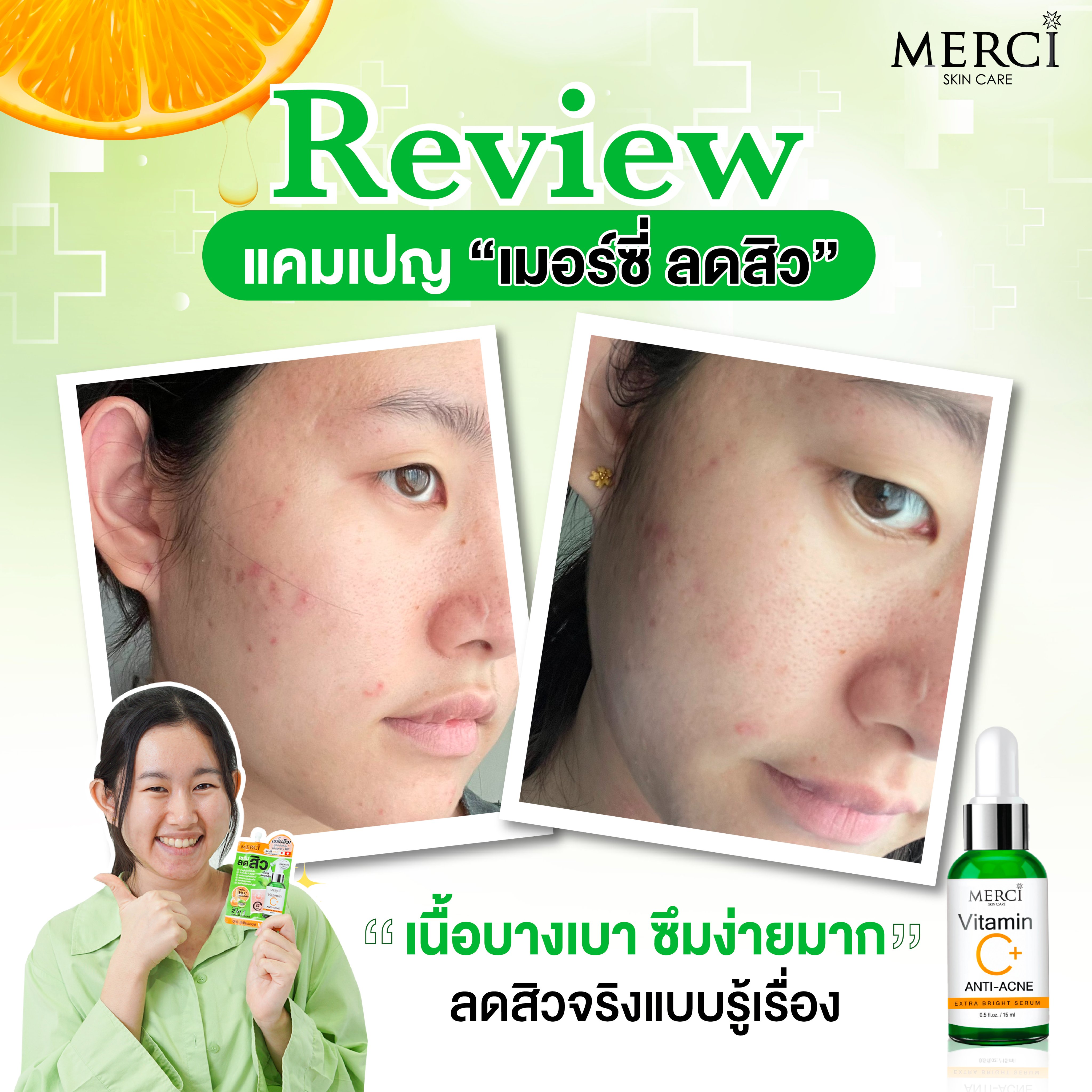 Merci_skincare (@merci_skincare) / Twitter