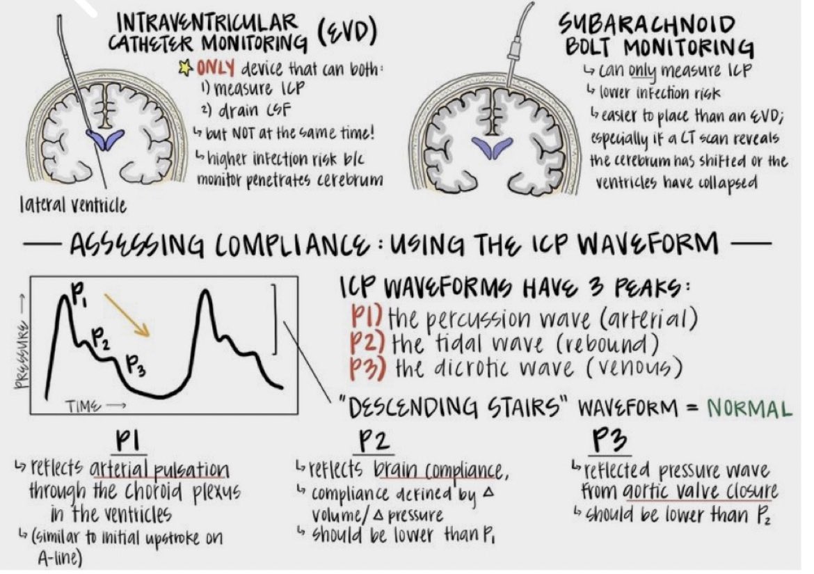 Oren Gottfried, MD on Twitter: "Basics on intracranial pressure. BTW, coughing, sneezing, and ...