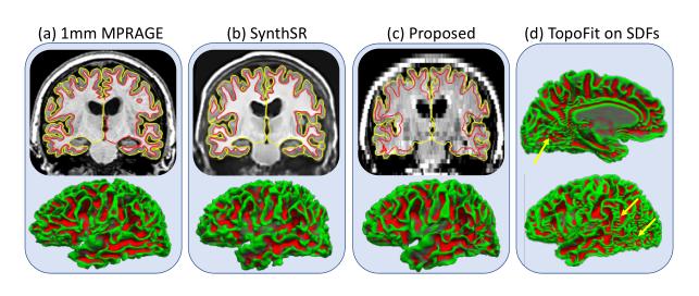 Daily AI Papers on Twitter: "Cortical analysis of heterogeneous clinical brain MRI scans for ...