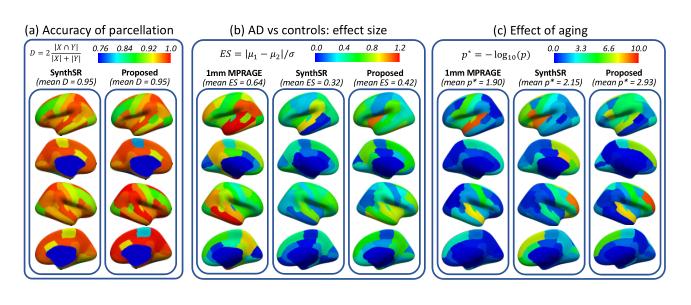 Daily AI Papers on Twitter: "Cortical analysis of heterogeneous clinical brain MRI scans for ...