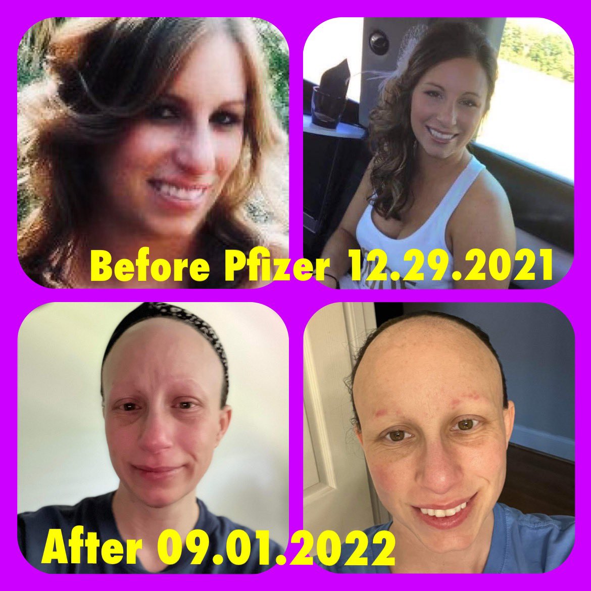 💚Lyndsey, RN💋 on Twitter: "~> Vax Injury Awareness