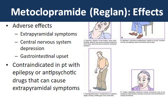 Extrapyramidal Symptoms. Metabolic Effects Of Atypical Antipsychotics