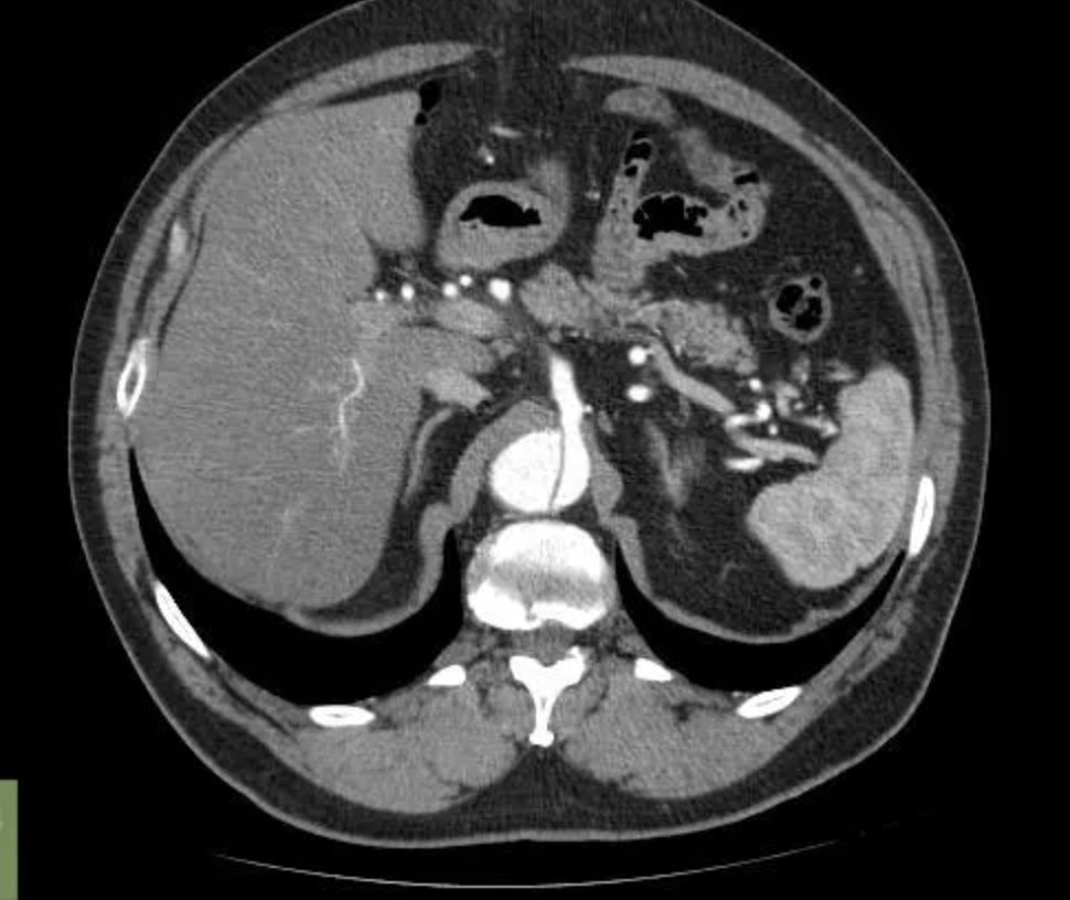 Radrounds Radiology Network On Twitter Diagnosis