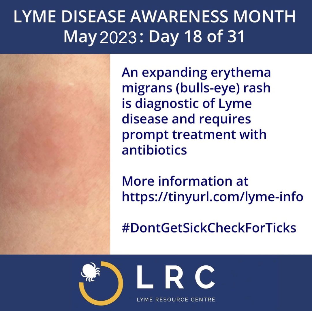 Erythema Migrans Lyme