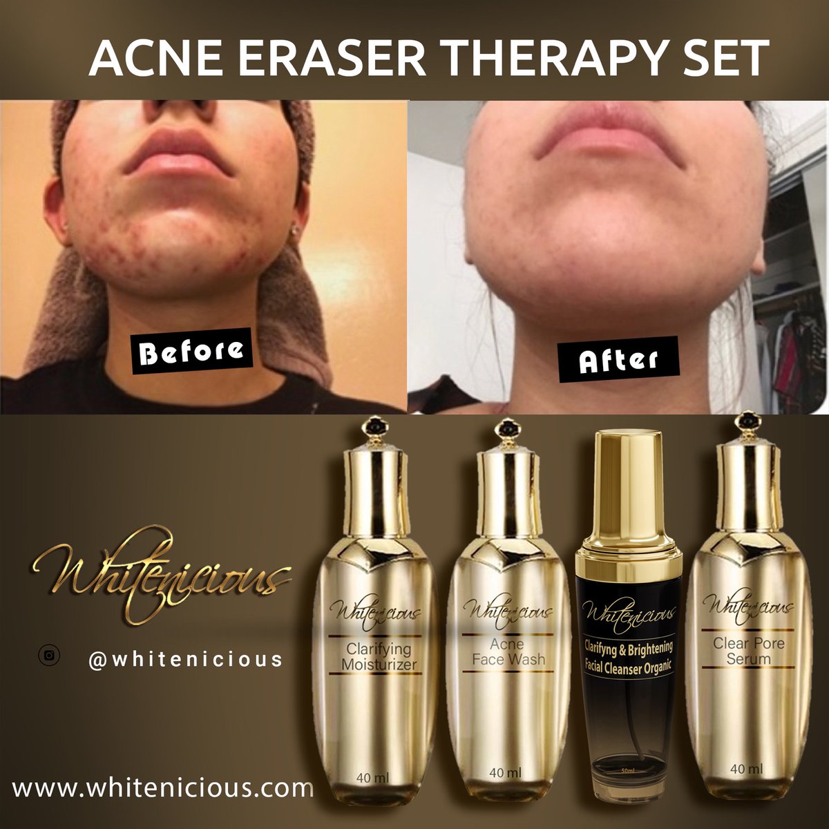Whitenicious Before And After Blac Chyna To Launch Skin Lightening