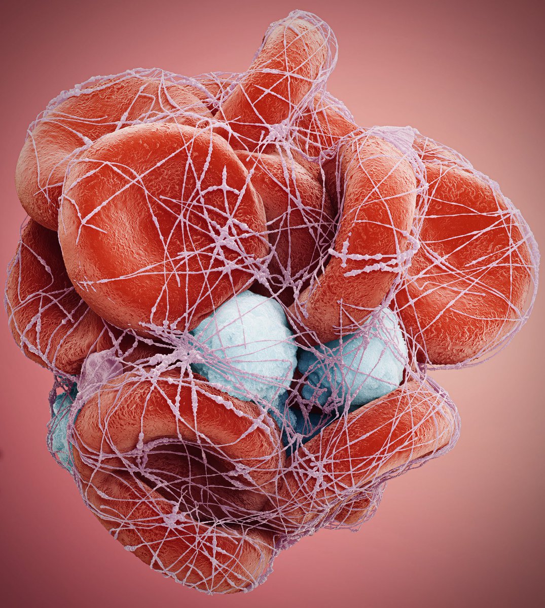 microscopic images. on Twitter: "red and white blood cells surrounded by fibrin fibers (blood clot)"