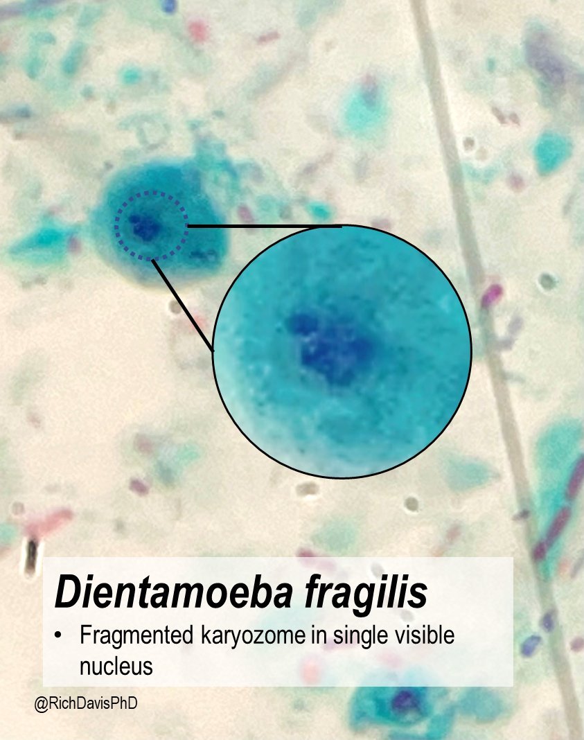 Dientamoeba Fragilis