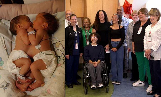 Conjoined Quadruplets