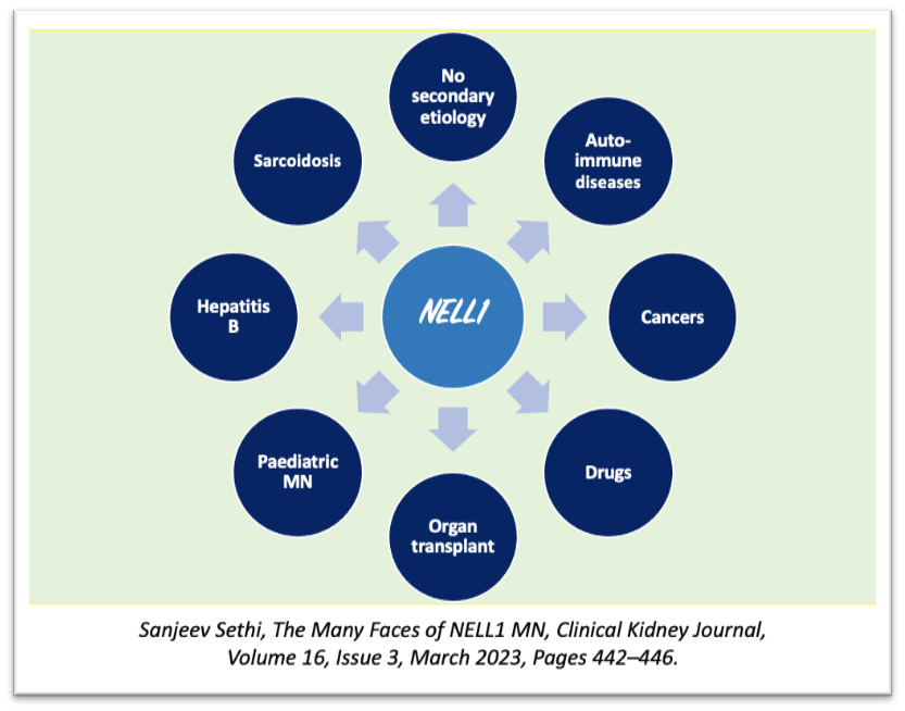 Hey #NephTwitter #Medtwitter! ⚠️How often do you see a family of cases ...