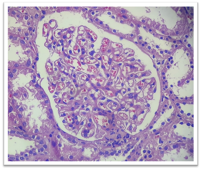 Hey #NephTwitter #Medtwitter! ⚠️How often do you see a family of cases ...