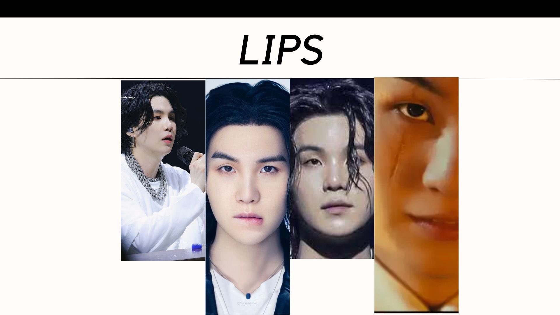 Simple Lip Laceration