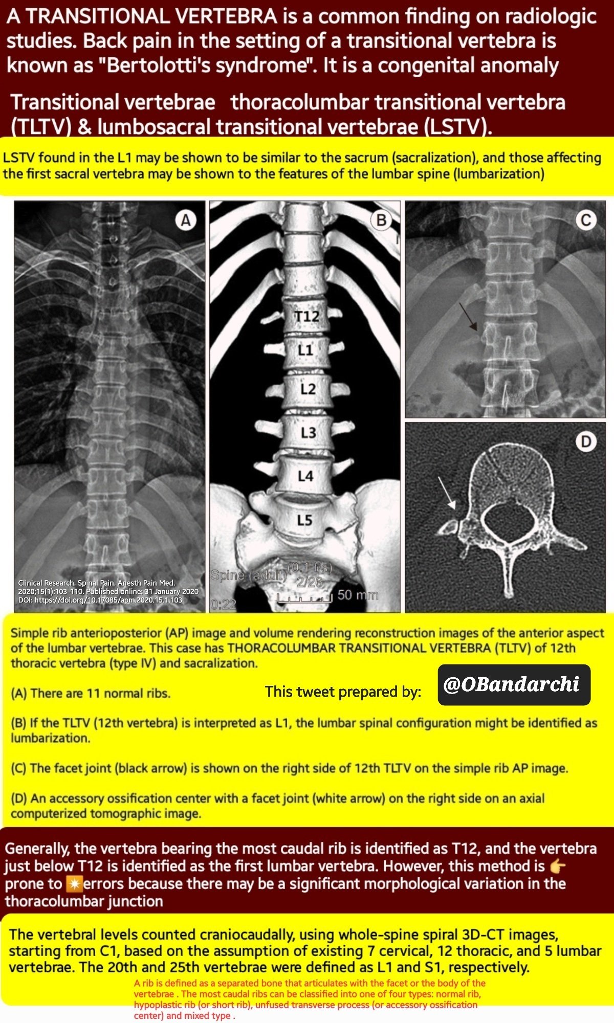 Lumbarization Vs Sacralization