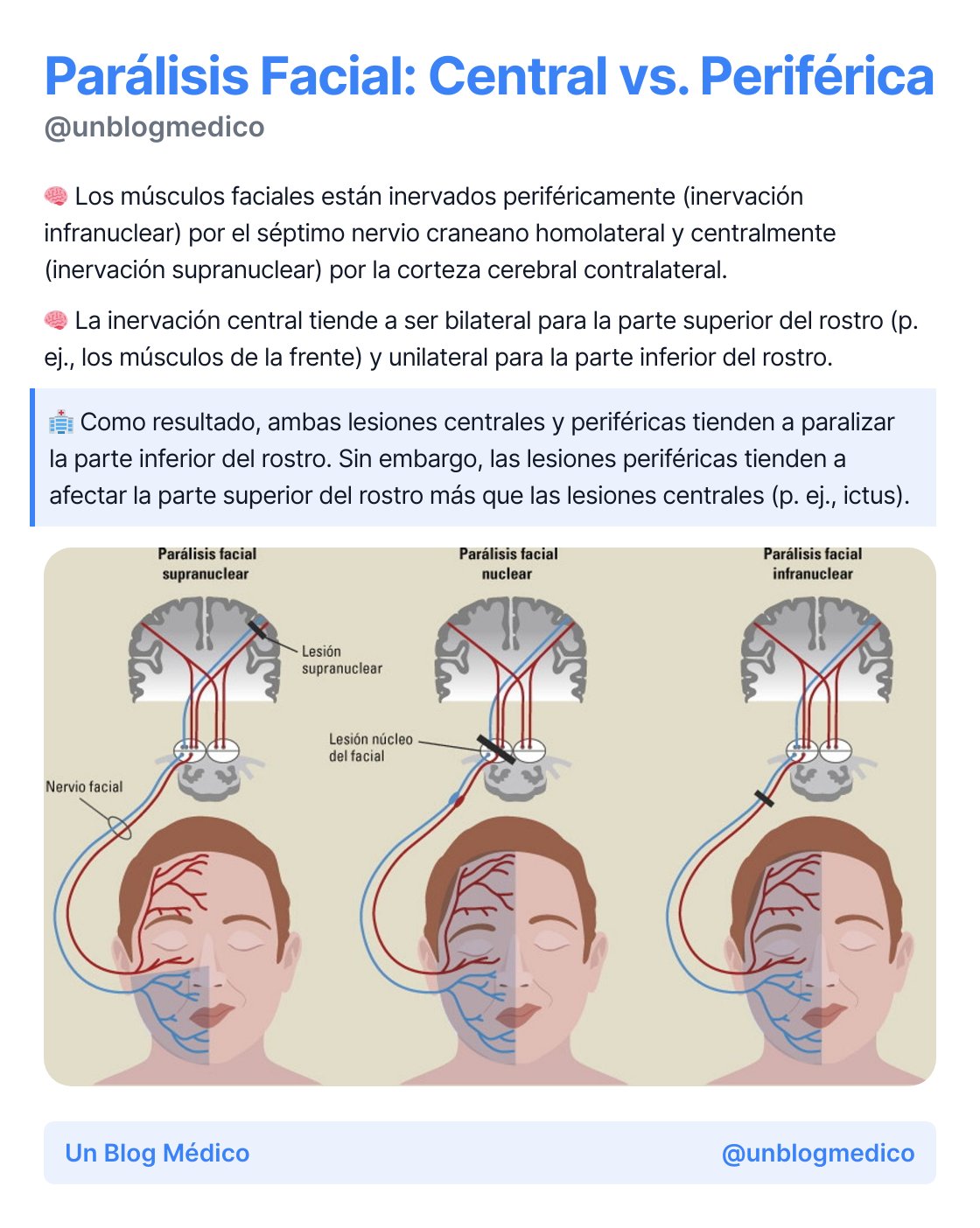 Protocolo Diagnóstico De La Afectación Del Nervio Facial, 59% OFF